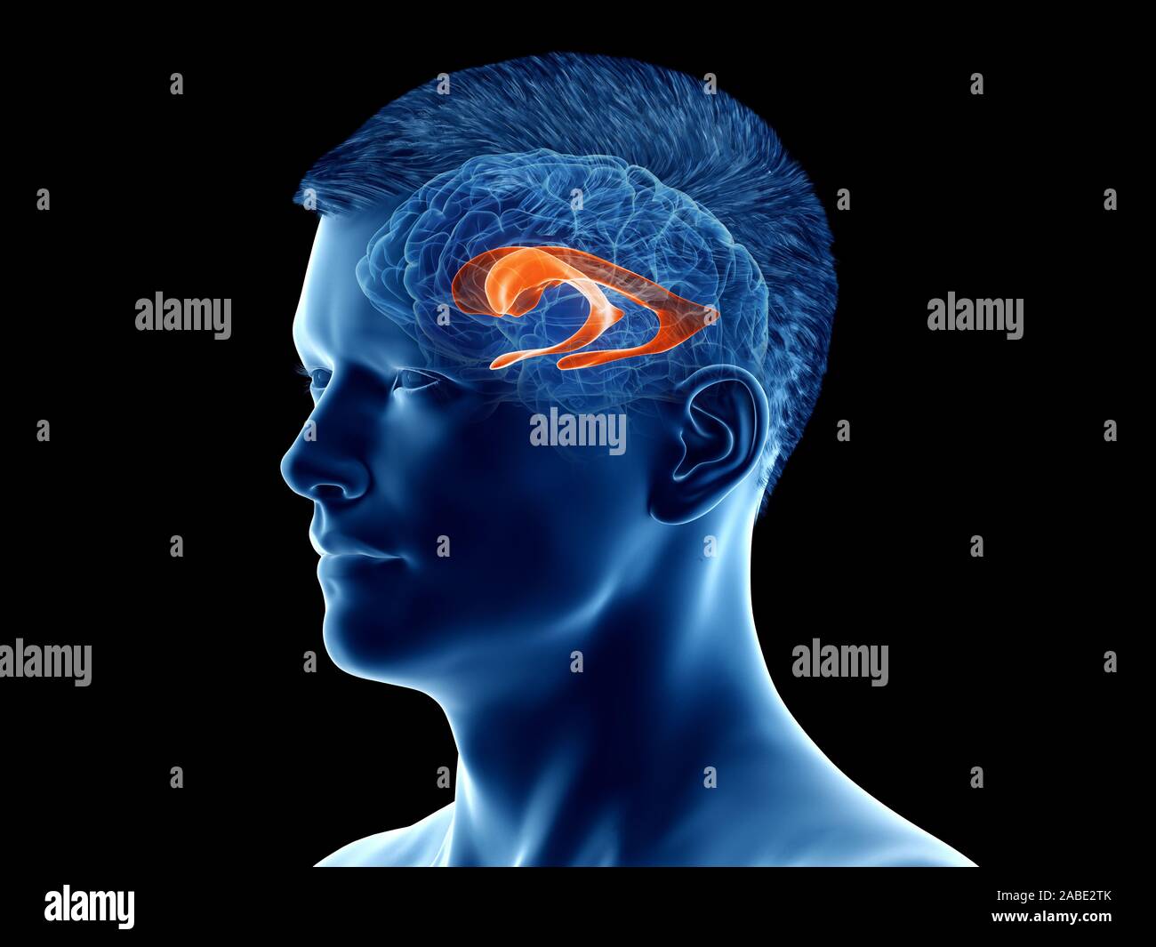 Lateral ventricle immagini e fotografie stock ad alta risoluzione - Alamy