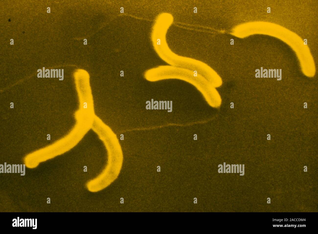 Micrografia al microscopio elettronico a scansione (SEM), colorate di ...