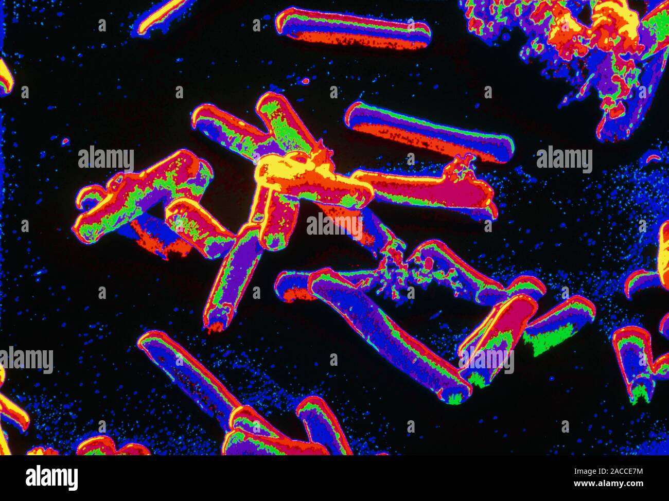 Clostridium tetani. Color scanning electron microfotografia (SEM) di un ...