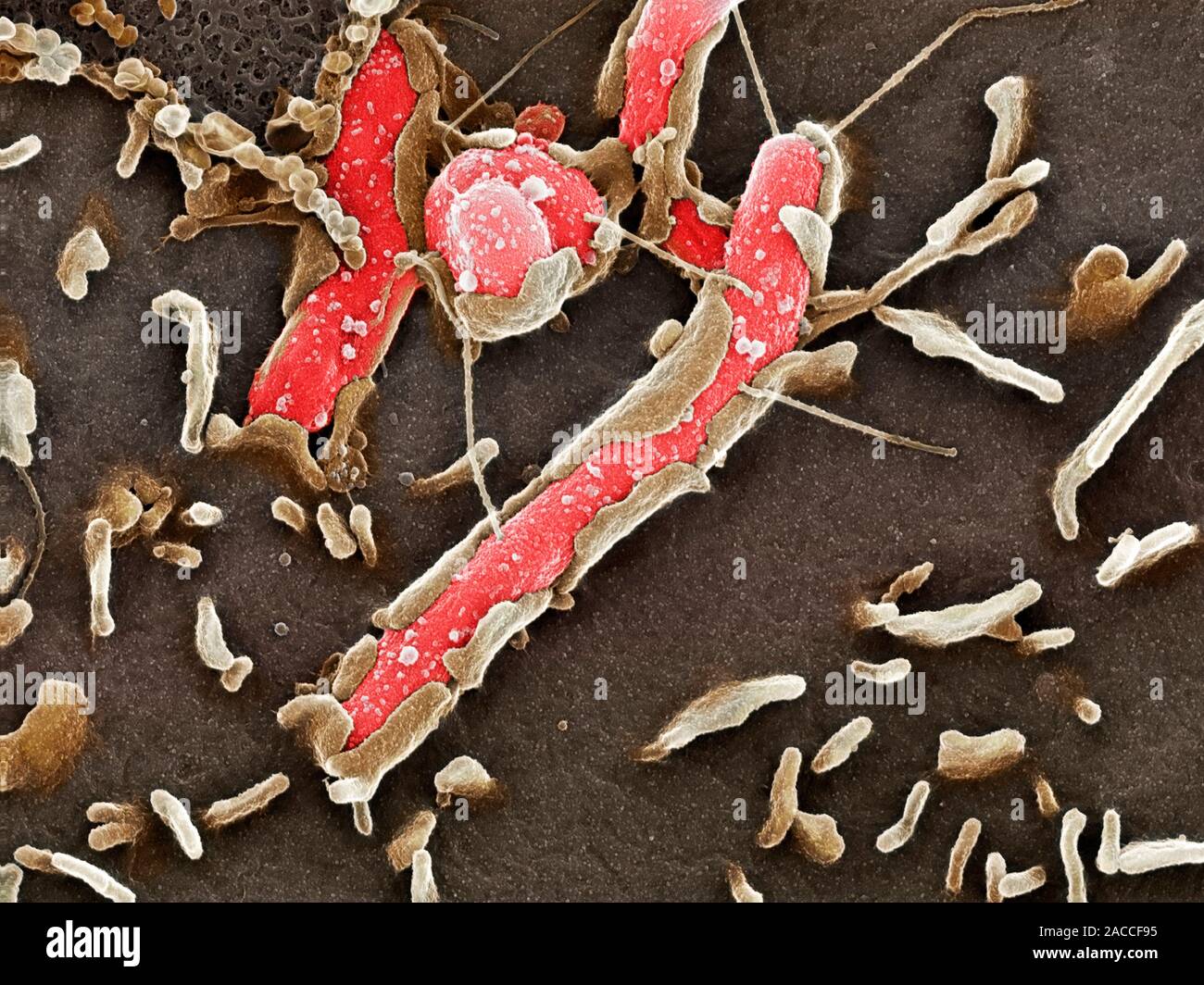 Helicobacter pylori. Color scanning electron microfotografia (SEM) di H ...