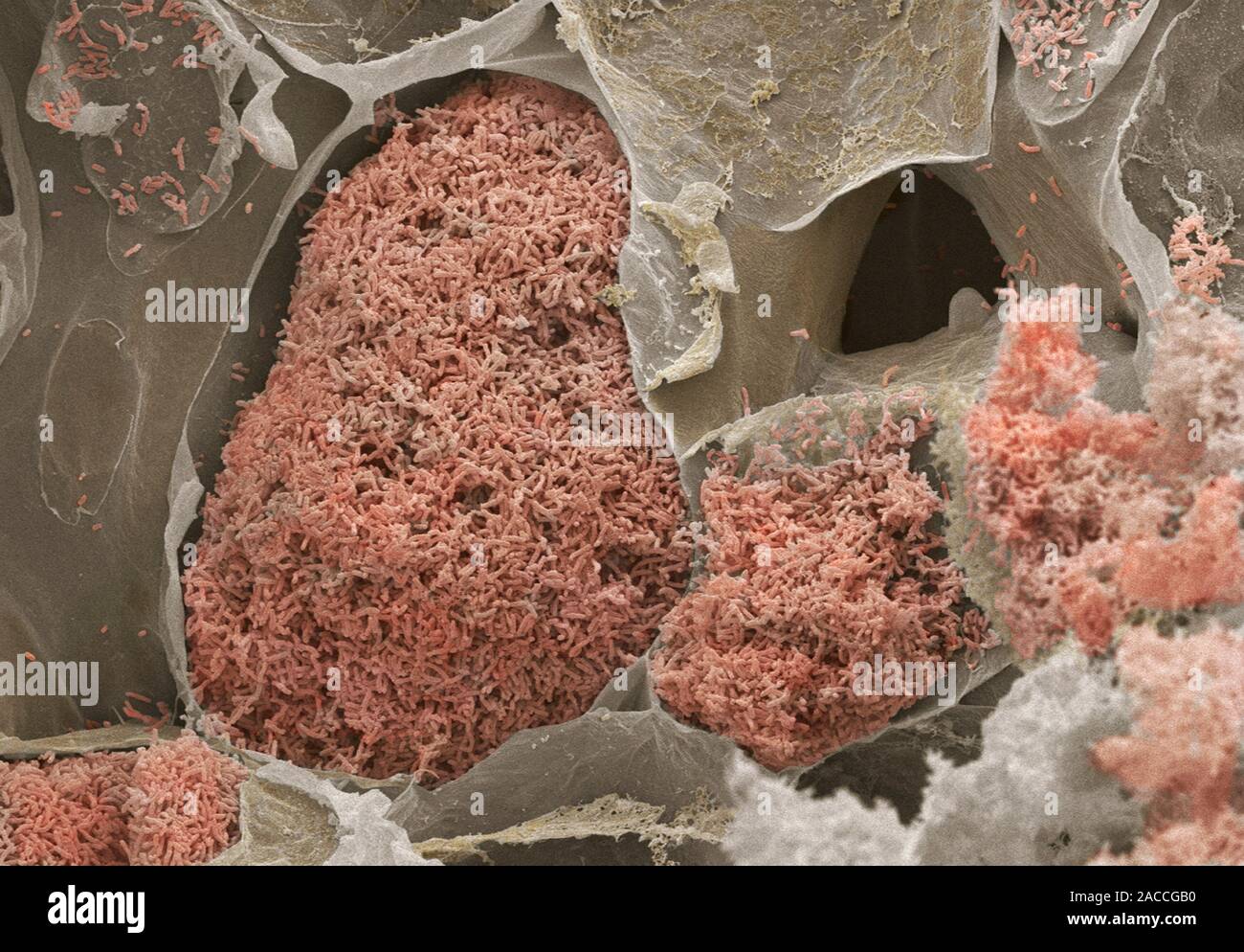 Batteri di azoto-fissazione. Color scanning electron microfotografia ...