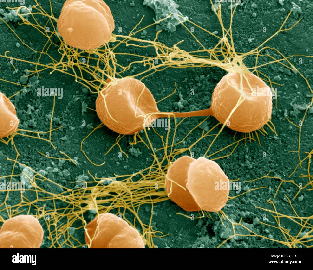 Pyrococcus furiosus archaea, colorata di microfotografia electron ...