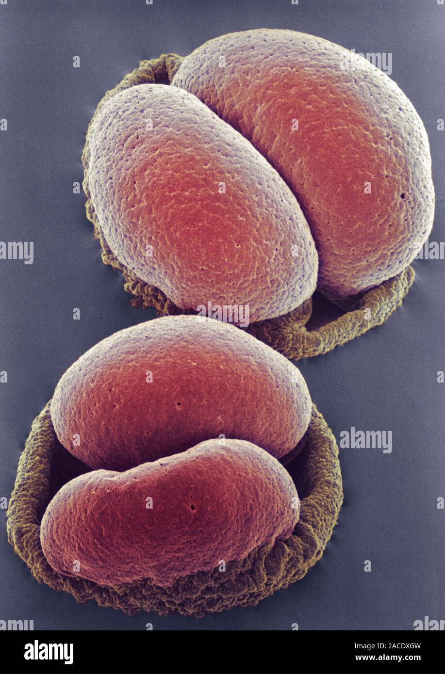 Il polline di pino. Color scanning electron microfotografia (SEM) di ...