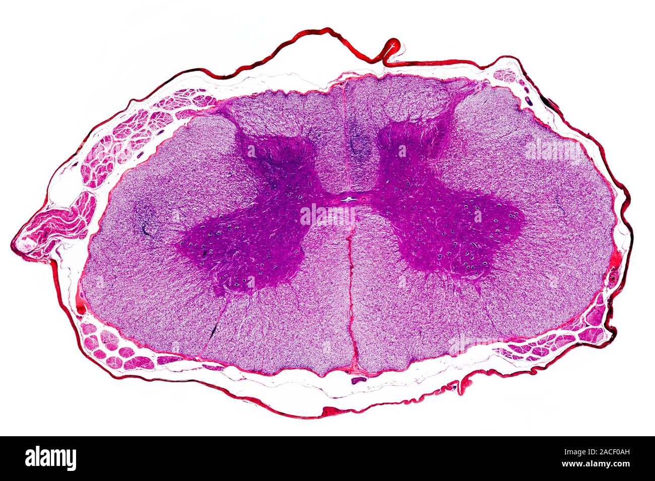 Il midollo spinale. Micrografia di luce di una sezione trasversale ...