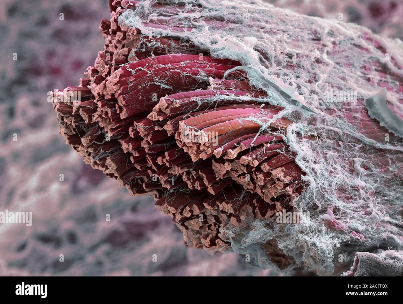 Il muscolo scheletrico fibre. Color scanning electron microfotografia ...