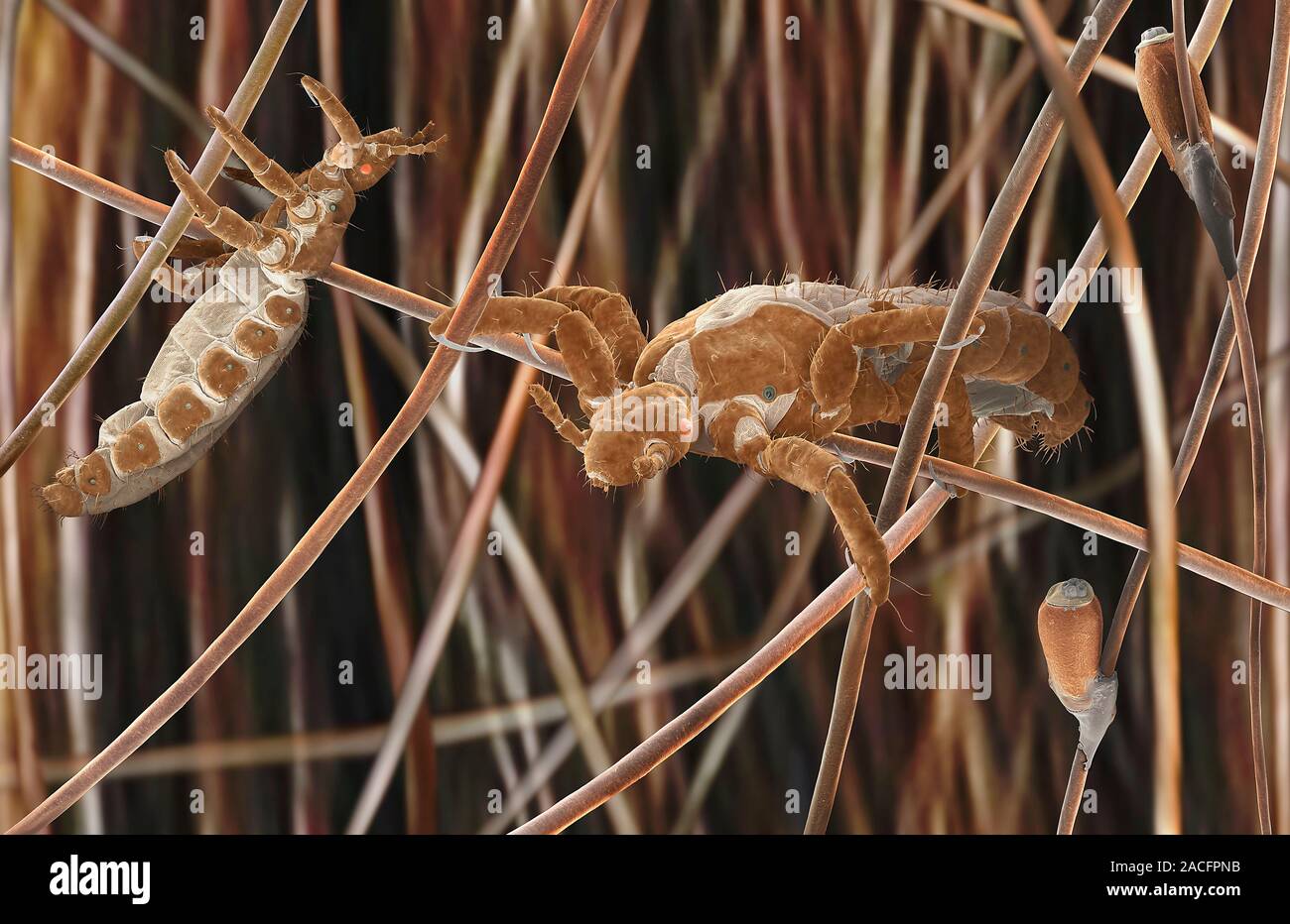 I pidocchi del corpo umano. Color scanning electron microfotografia ...