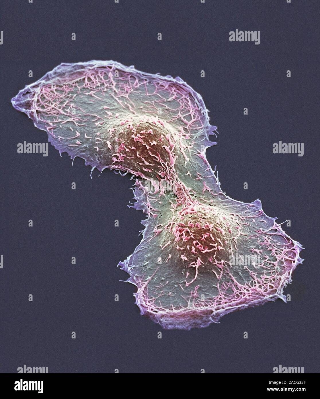 Cellule HeLa la divisione cellulare. Color scanning electron ...