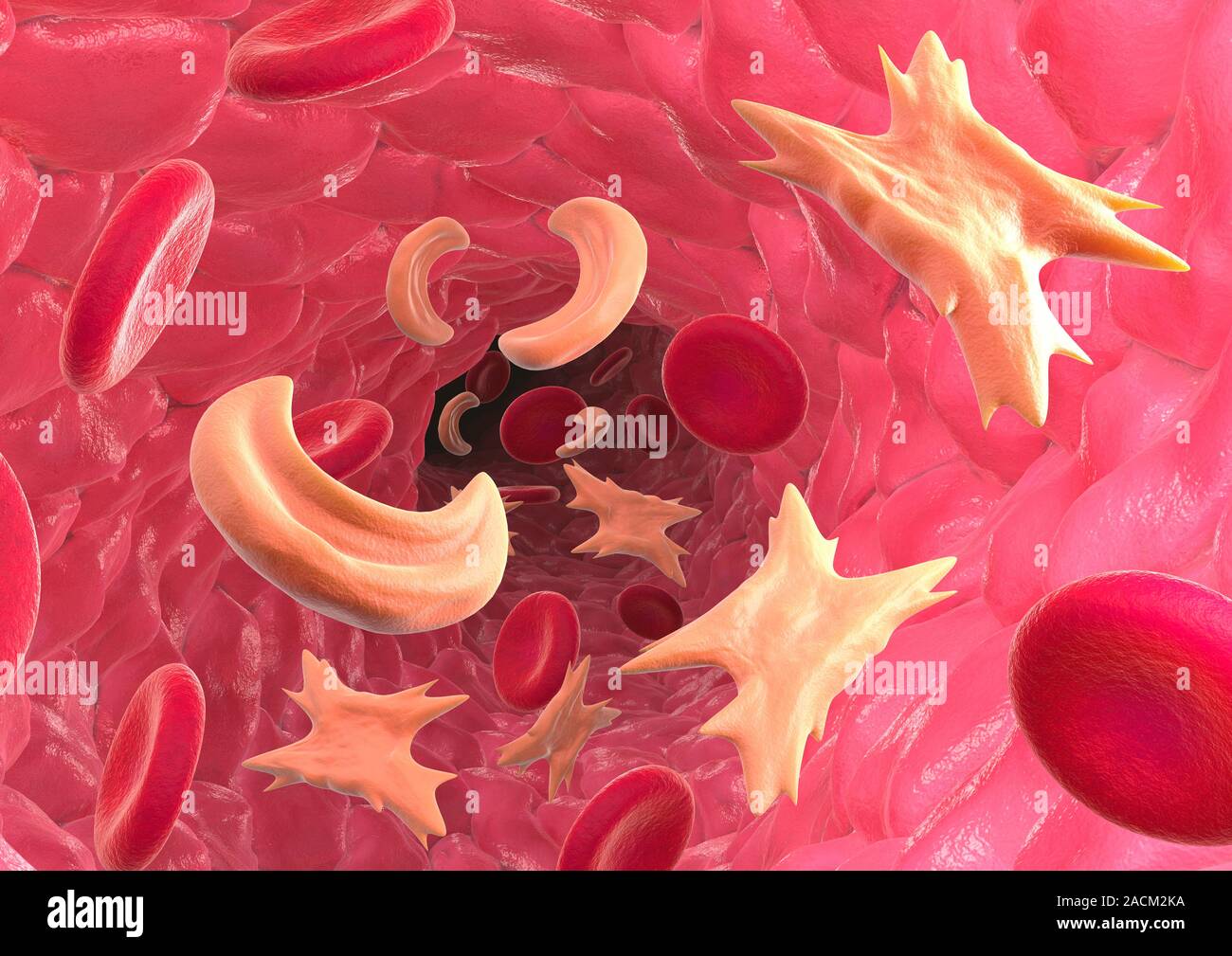 Anemia Falciforme Computer Grafica Dei Normali Globuli Rossi