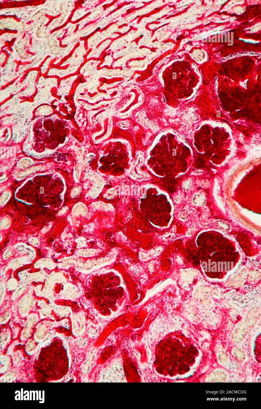 Il rene. Micrografia di luce di una sezione attraverso la corteccia di ...