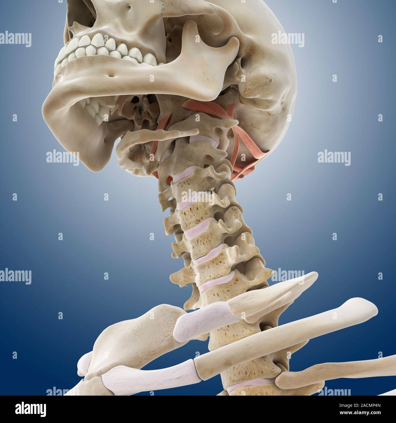 Suboccipital muscoli. Computer illustrazione di una vista frontale ...