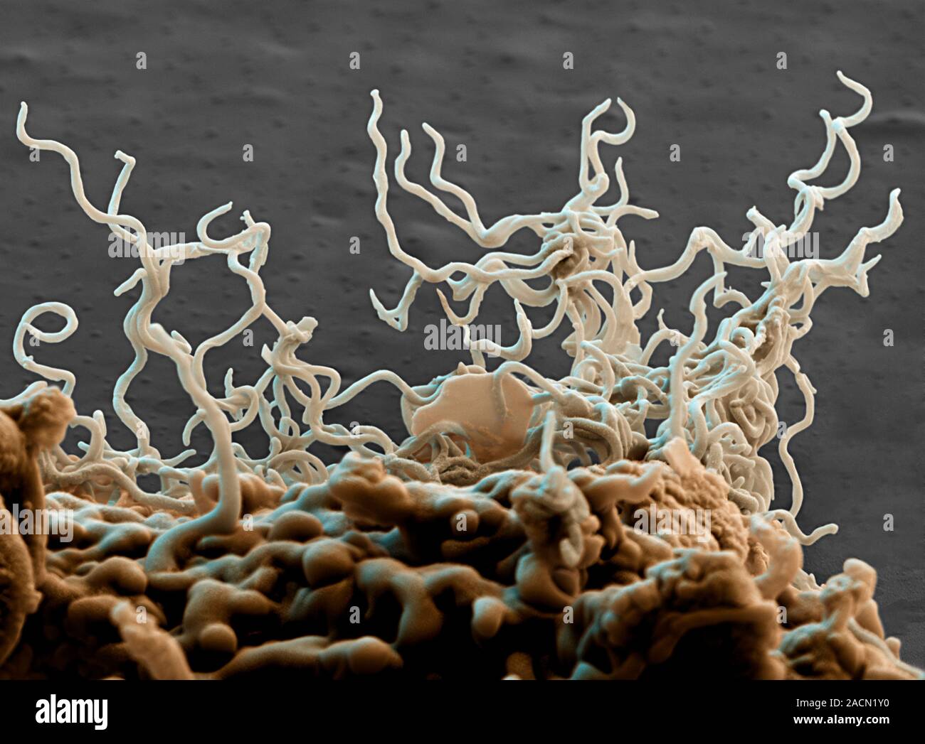 La malattia di Lyme batteri. Color scanning electron microfotografia ...