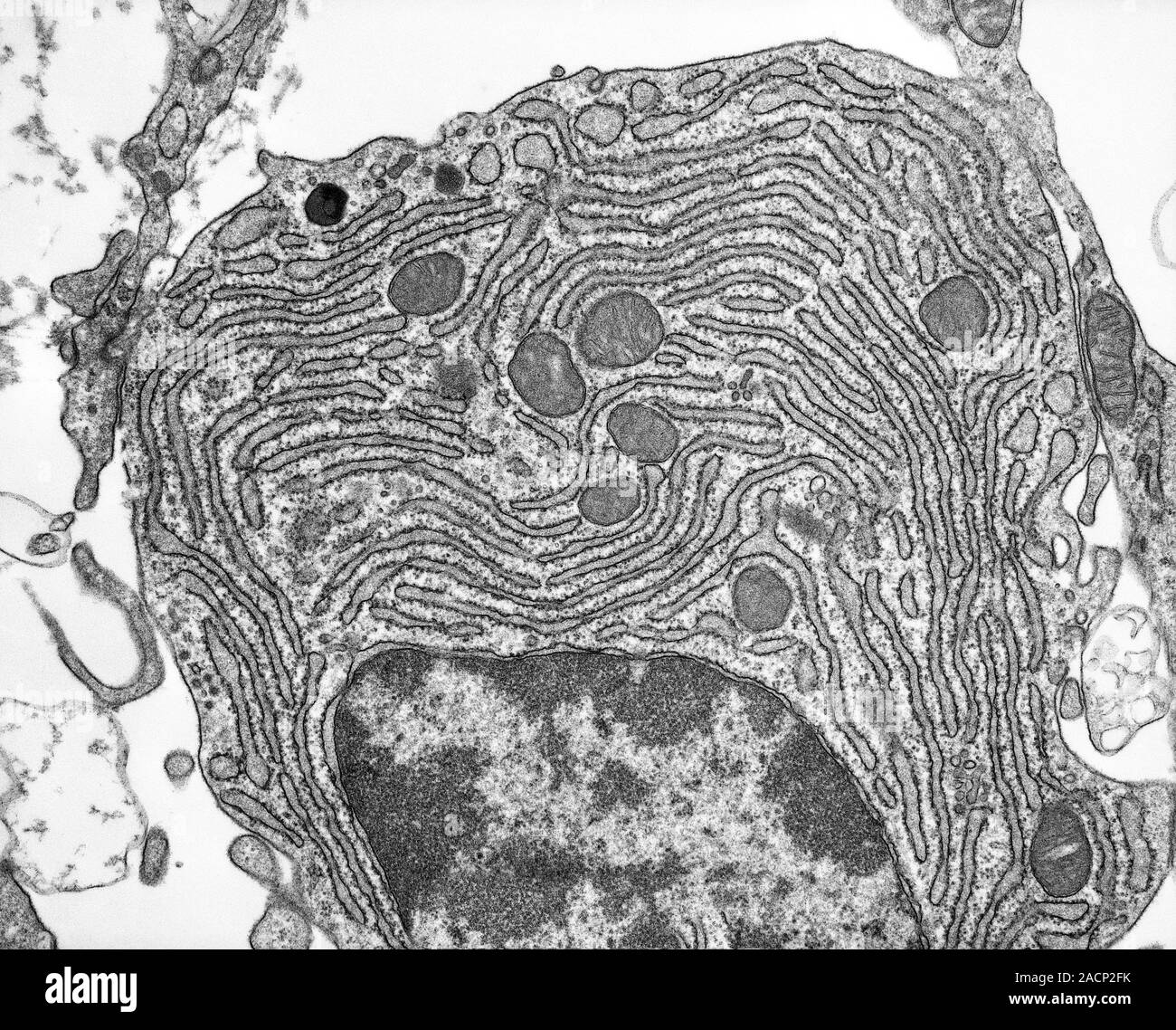 Reticolo endoplasmatico rugoso. Microscopio elettronico a trasmissione ...