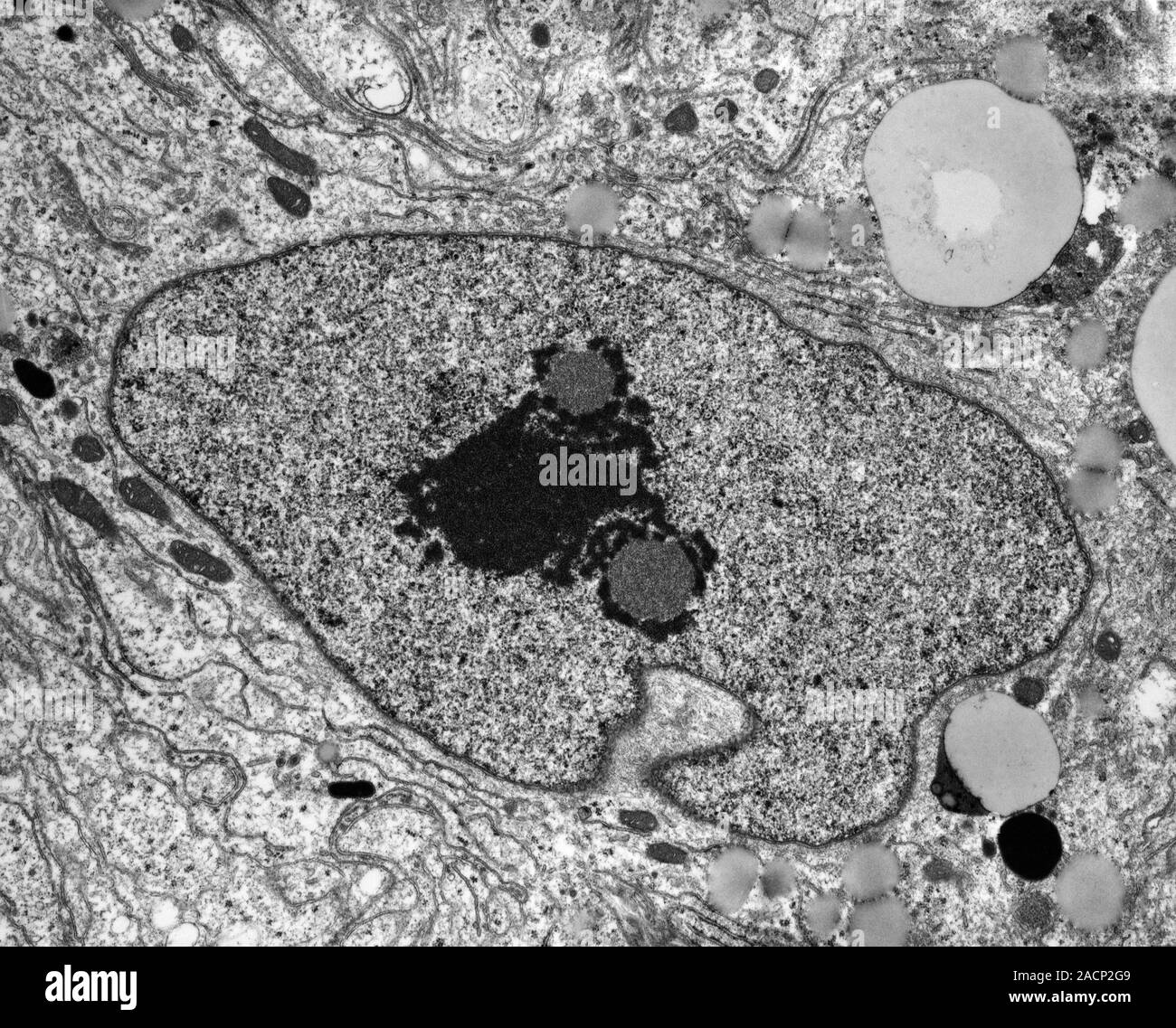 Cellula di Sertoli. Microscopio elettronico a trasmissione (TEM) di una ...