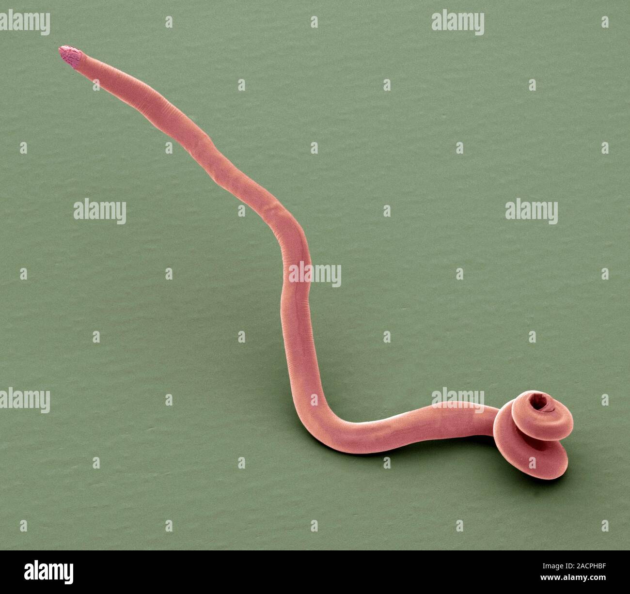 Gapeworm. Color scanning electron microfotografia di una femmina di ...
