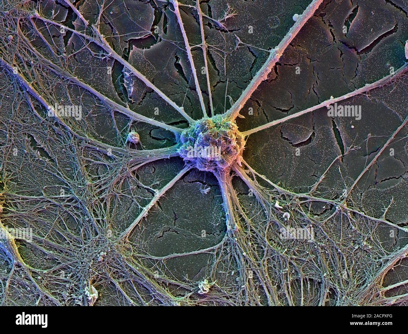 Cervello le cellule nervose. Micrografia al microscopio elettronico a ...
