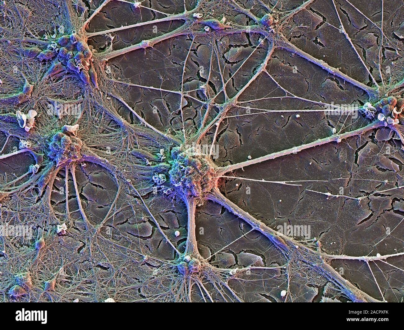 Cervello le cellule nervose. Micrografia al microscopio elettronico a ...