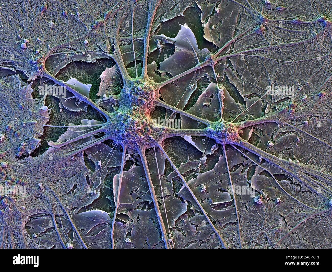 Cervello le cellule nervose. Micrografia al microscopio elettronico a ...