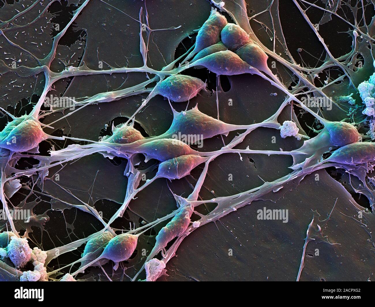 Le cellule cerebrali. Micrografia al microscopio elettronico a ...
