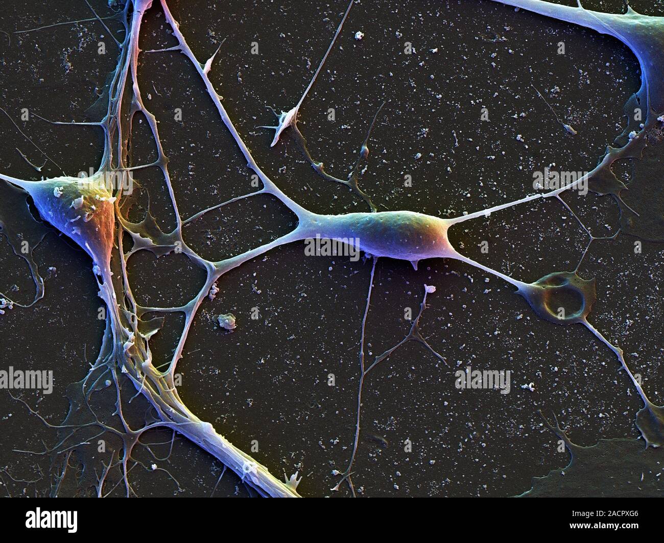 Le cellule cerebrali. Micrografia al microscopio elettronico a ...