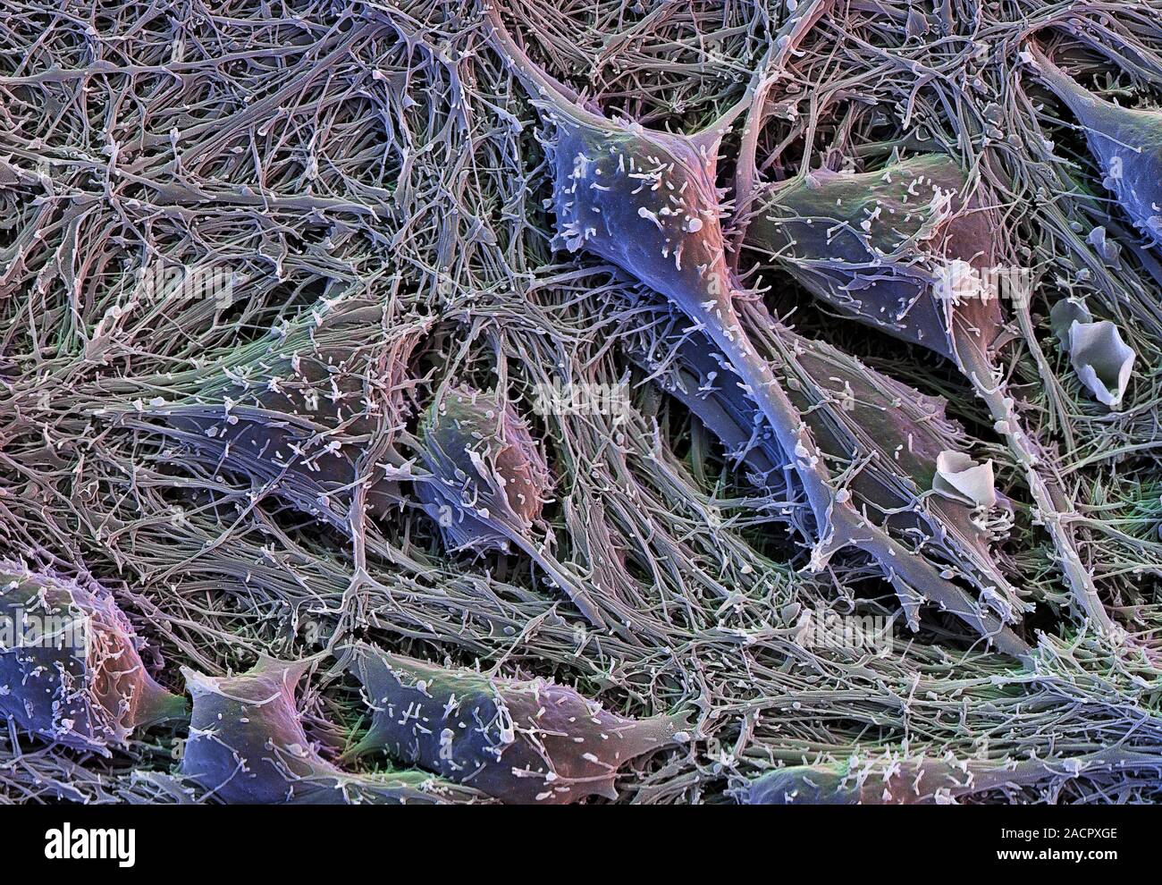 Cervello le cellule nervose. Micrografia al microscopio elettronico a ...