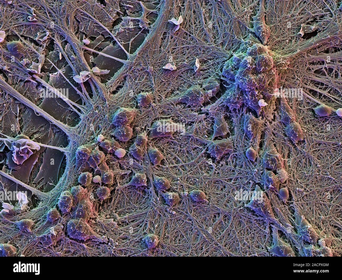 Cervello le cellule nervose. Micrografia al microscopio elettronico a ...