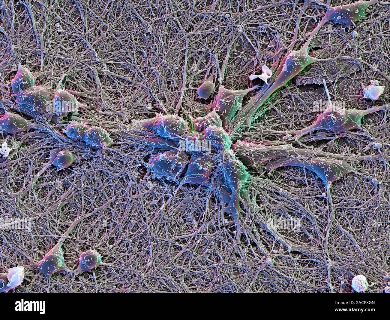 Cervello le cellule nervose. Micrografia al microscopio elettronico a ...