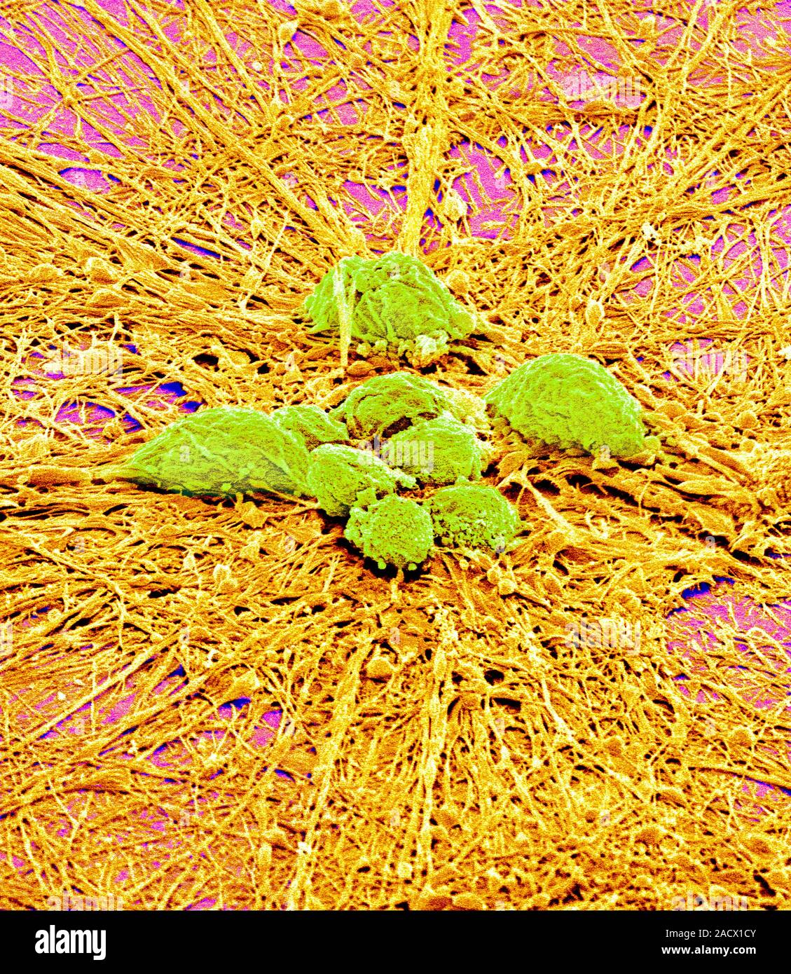 Le cellule del sistema nervoso. Color scanning electron microfotografia ...