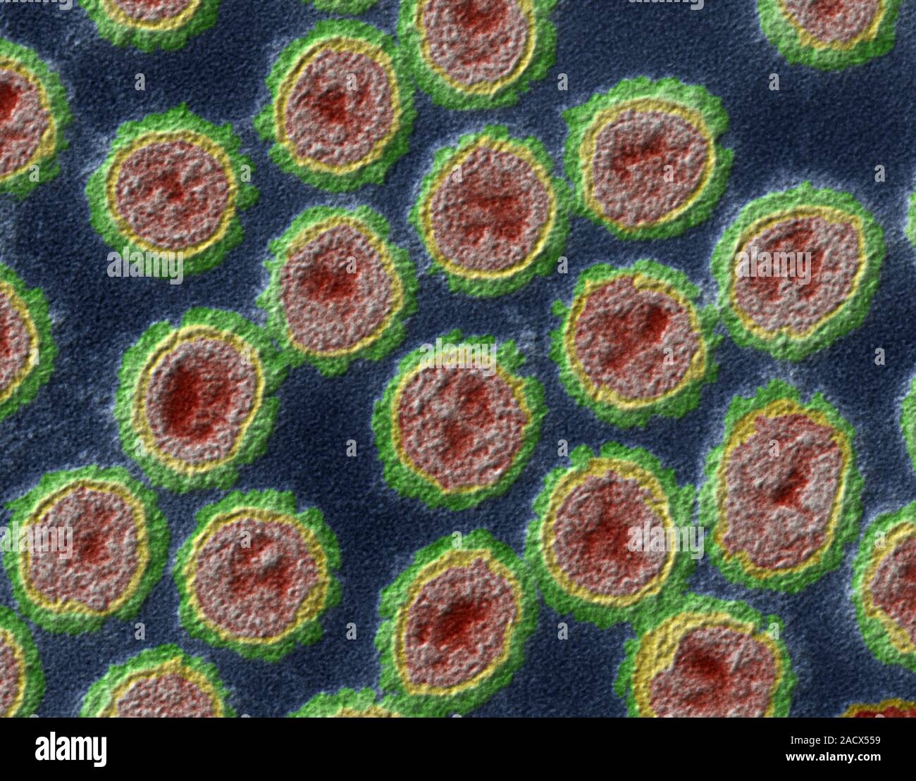 Influenza aviaria le particelle di virus, colorato di microscopio ...