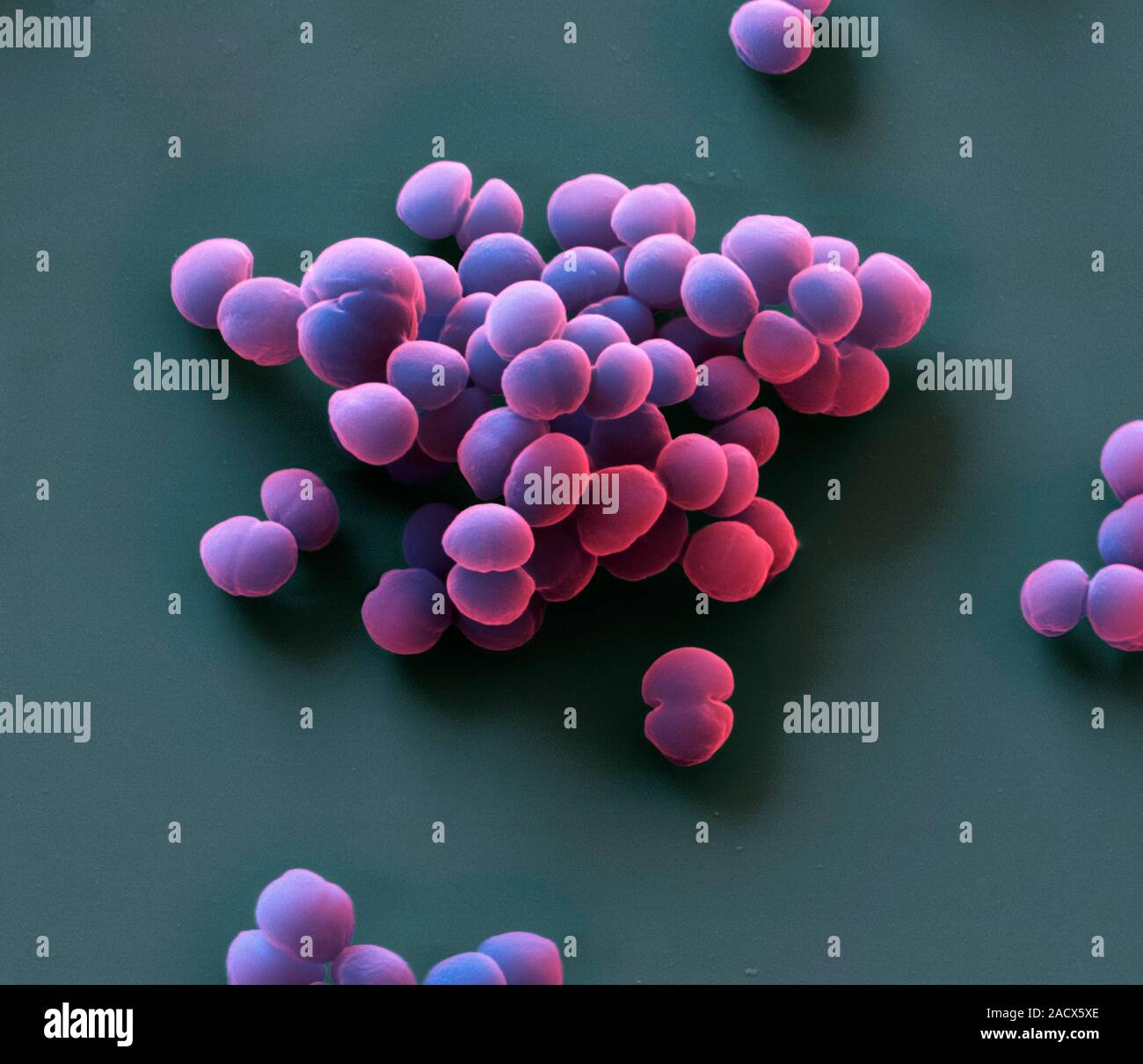 Lo Staphylococcus epidermidis batteri, colorata di microfotografia ...