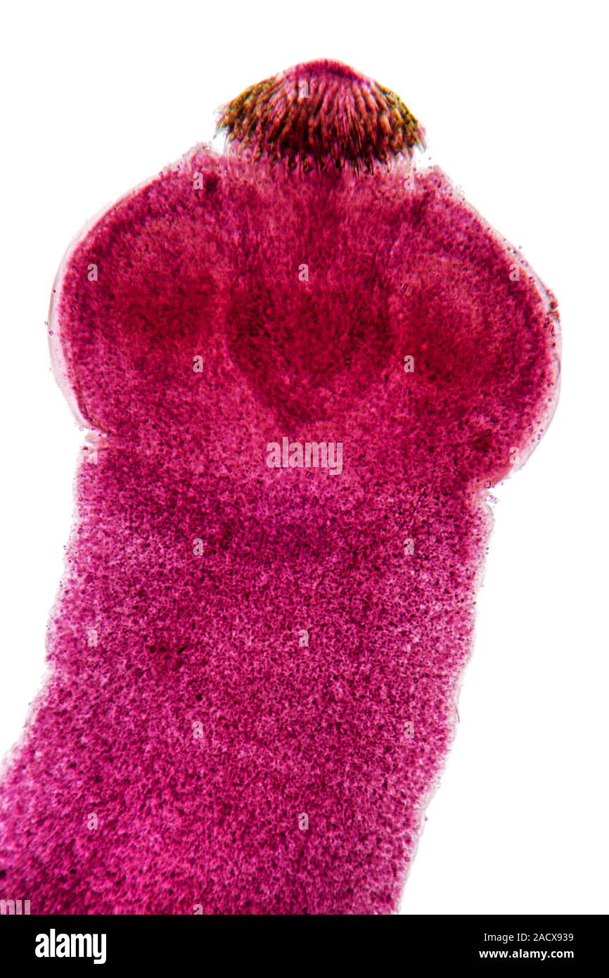 La tenia echinococco cysticercus. Micrografia luce della vescica di ...