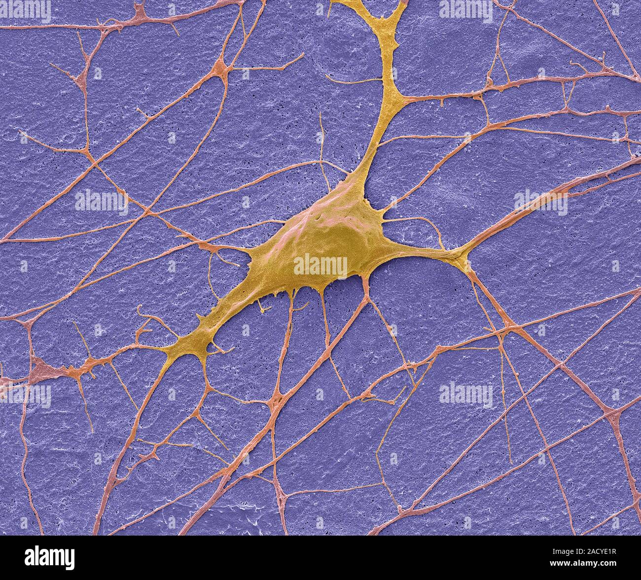 Le cellule staminali derivate da neurone motore. Color scanning ...