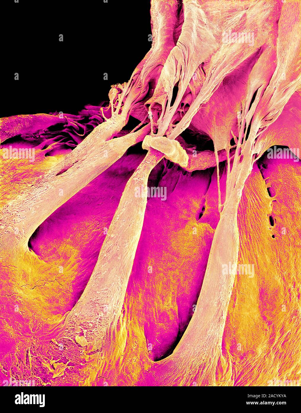 Valvola cardiaca e stringhe, colorata di microfotografia electron ...
