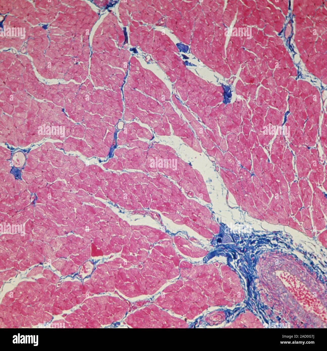 Il muscolo cardiaco. Micrografia di luce di una sezione trasversale ...