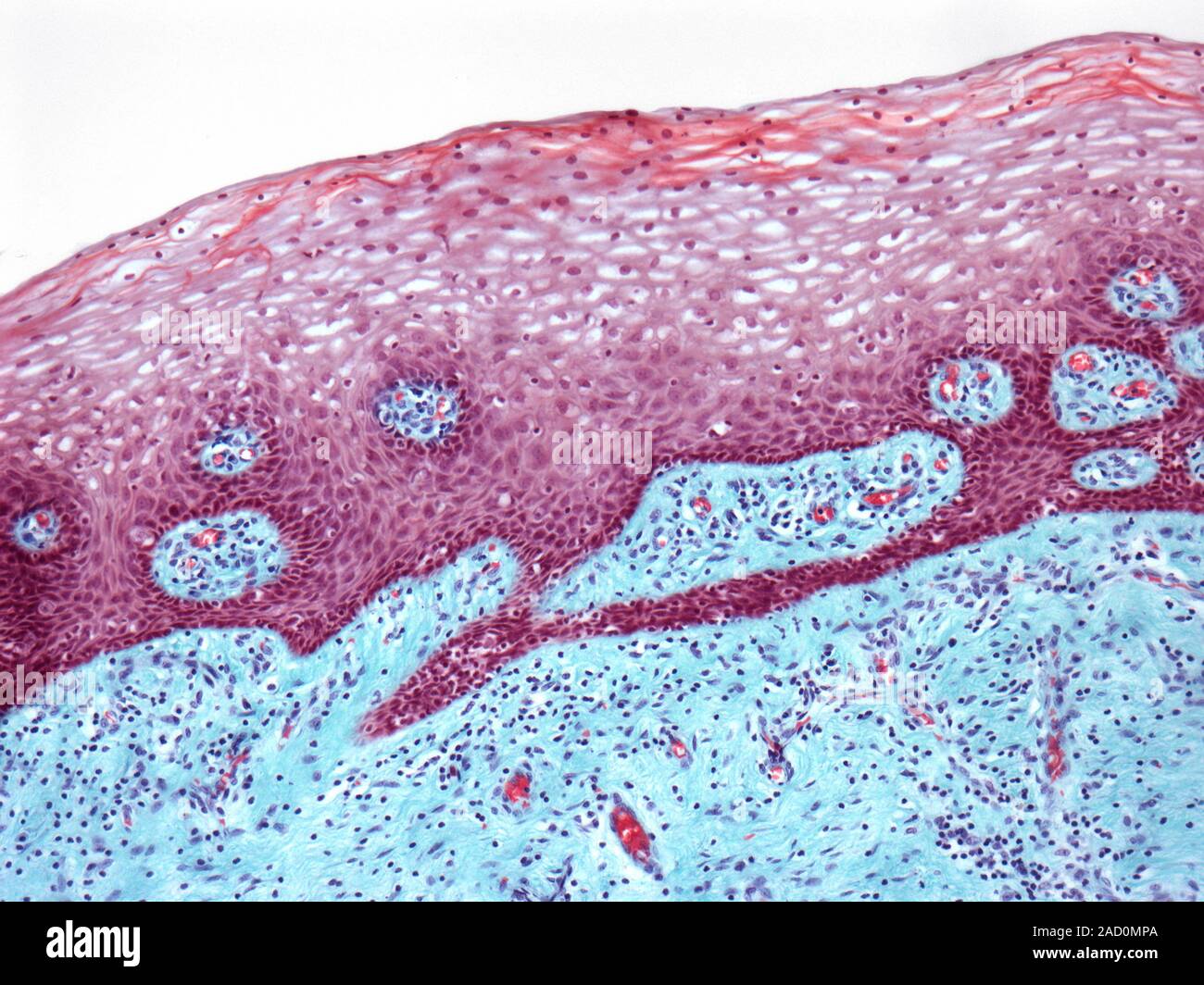Cervice umano. Micrografia di luce di una sezione attraverso l'epitelio ...