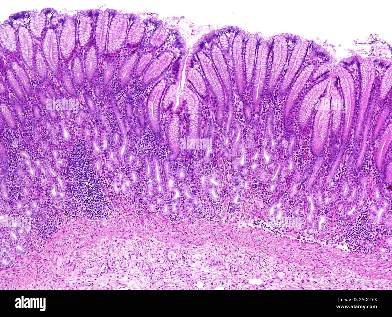 Microscopia a luce dell'epitelio interno rivestimento dello stomaco ...