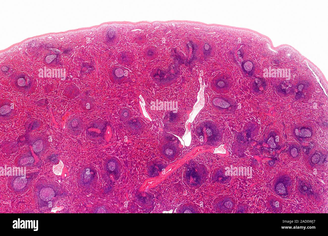 Microscopia a luce di milza di primati che mostrano a polpa bianca (blu ...