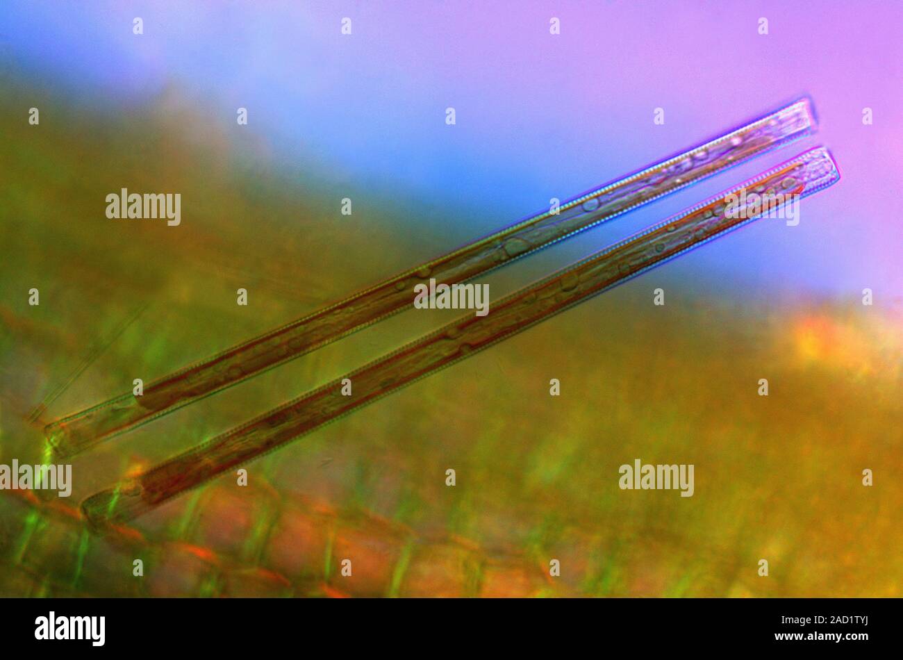 Synedra diatomee. La luce polarizzata micrografia di Synedra sp ...
