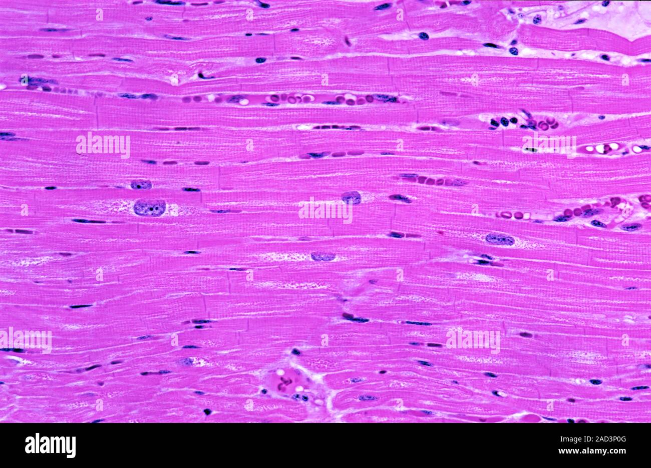 Microscopio ottico di una sezione longitudinale del muscolo cardiaco ...