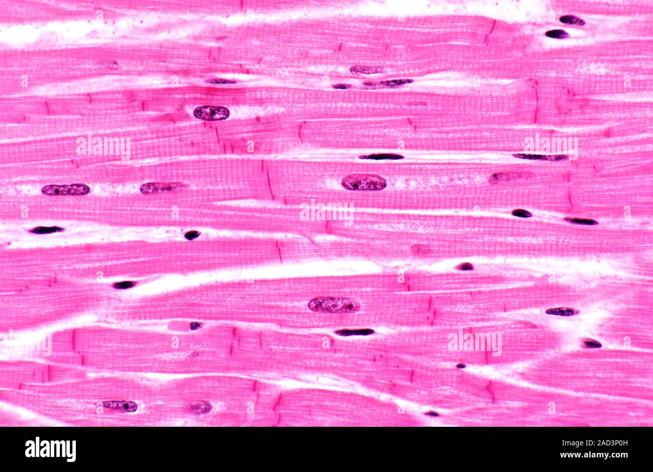 Microscopio ottico di una sezione longitudinale del muscolo cardiaco ...