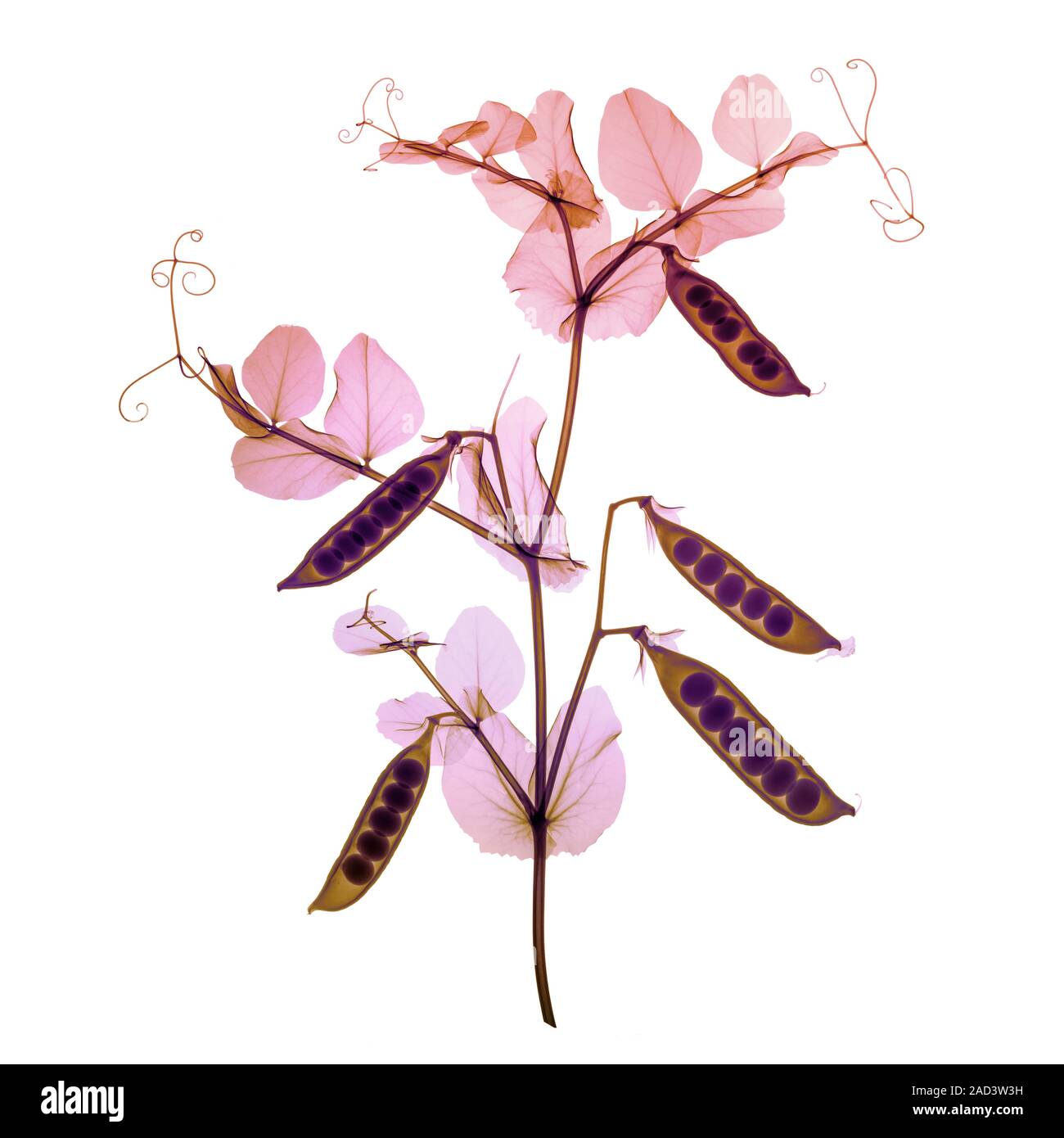 Pianta di pisello di frutta. Colorato X-ray di un pisello (Pisum ...