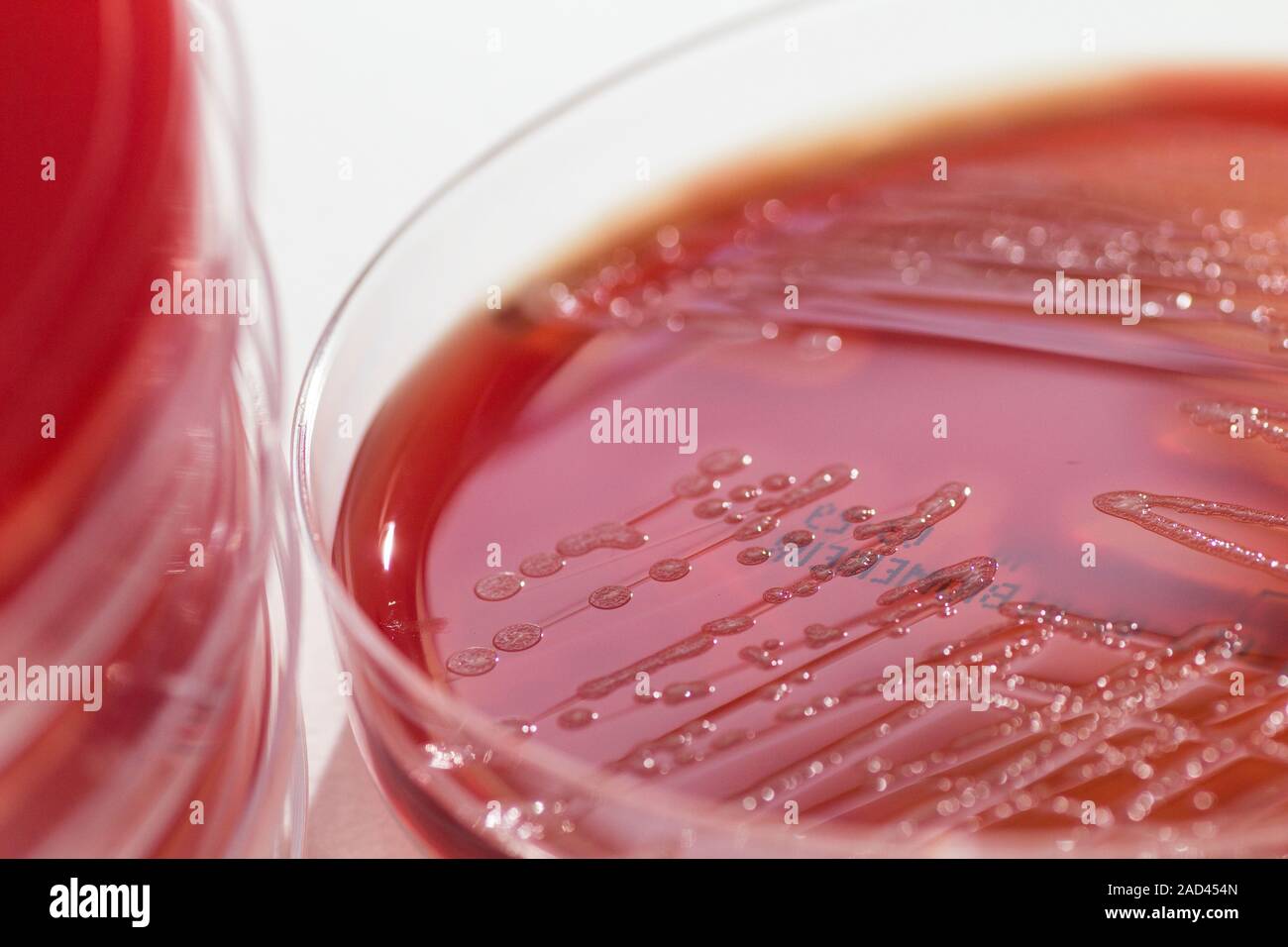La cultura di Streptococcus pyogenes (gruppo A streptococchi) su agar ...
