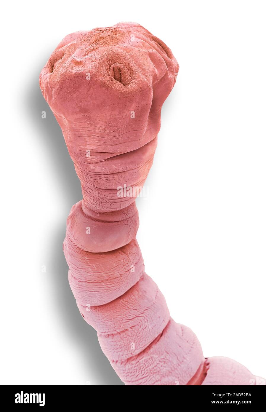 La tenia echinococco metacestode. Scanning electron microfotografia ...