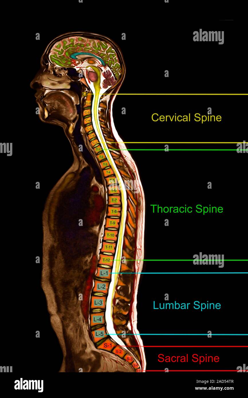 Regioni della colonna vertebrale. Etichettati a colori convertiti ...