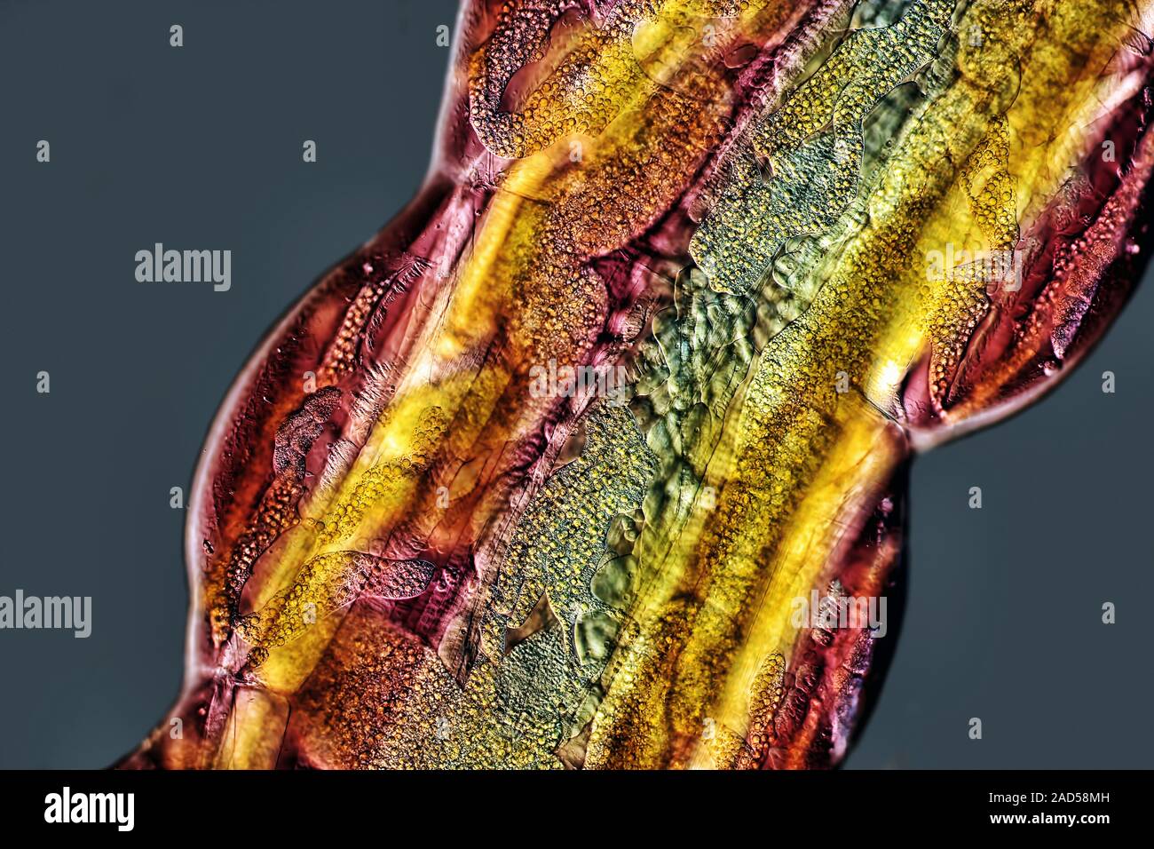 Midge larva. La luce polarizzata micrografia di segmenti addominali di ...
