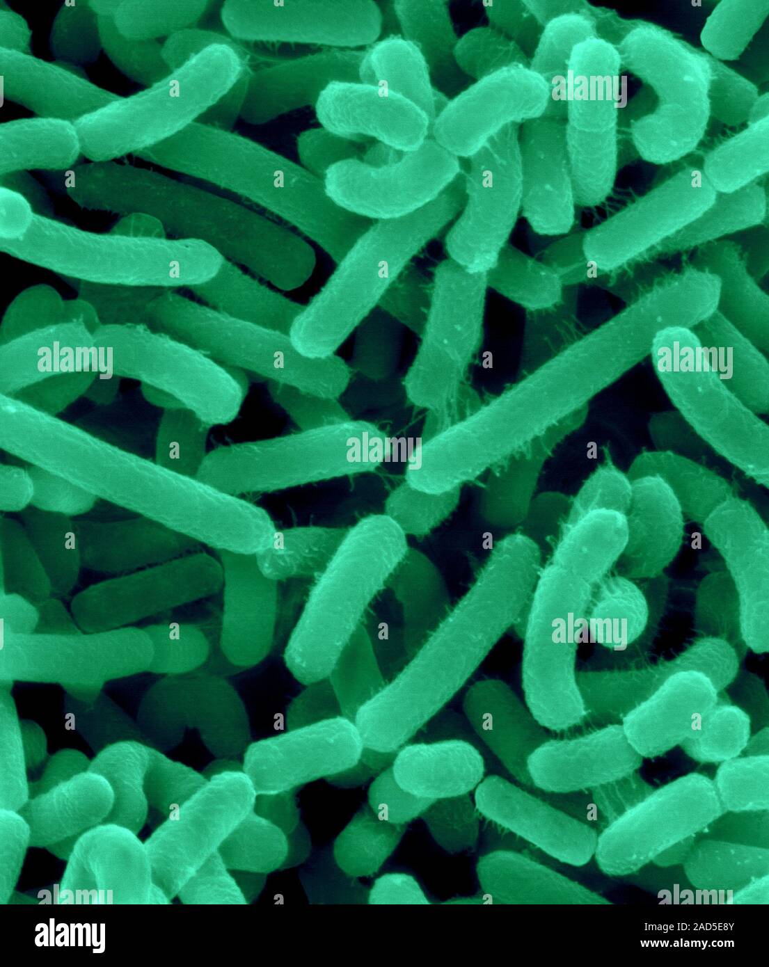 Color scanning electron microfotografia (SEM) di Agrobacterium ...