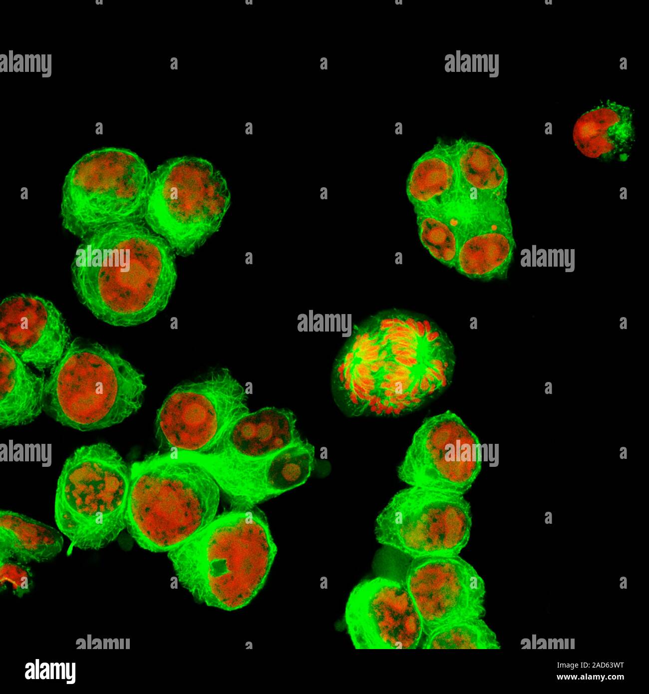 Cellule di neuroblastoma. Luce di fluorescenza micrografia di cellule ...