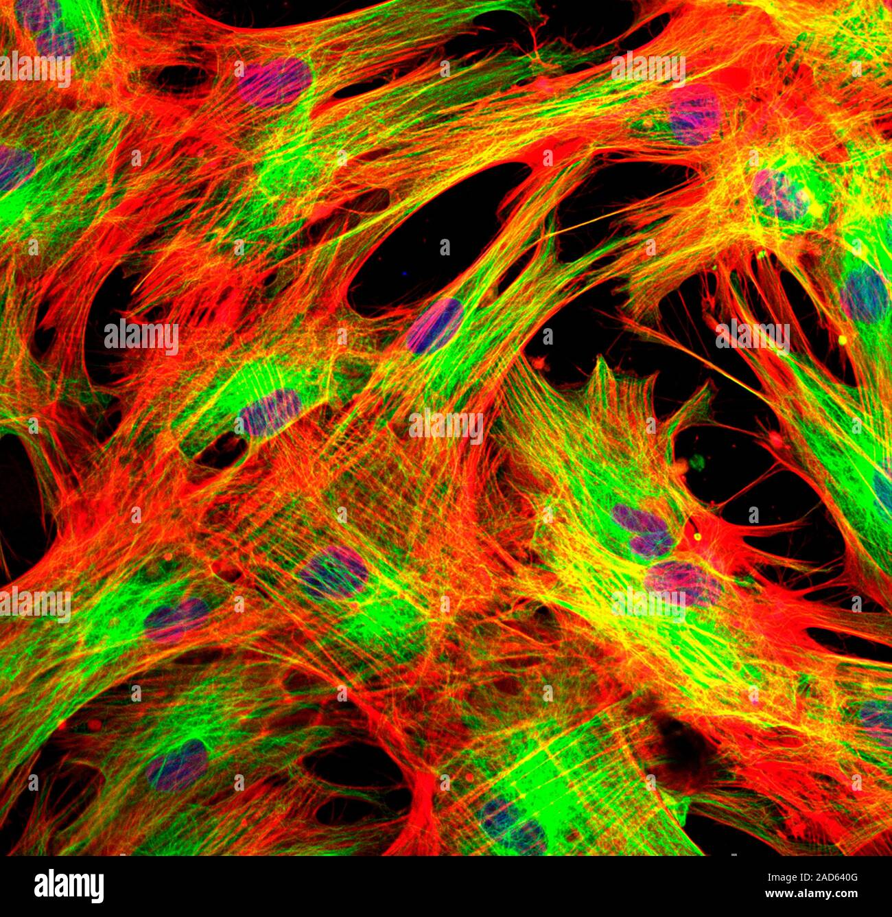 Fibroblasti cellule della pelle. Luce di fluorescenza micrografia di ...
