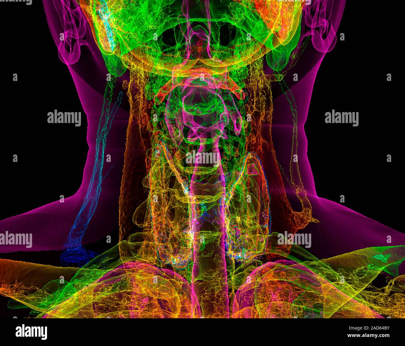 Umano anatomia del collo. Migliorate digitalmente 3D tomografia ...