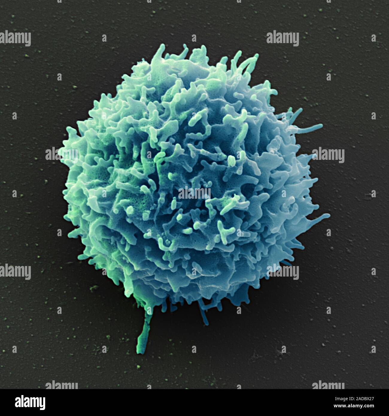 Color scanning electron microfotografia (SEM) di cellule natural killer ...