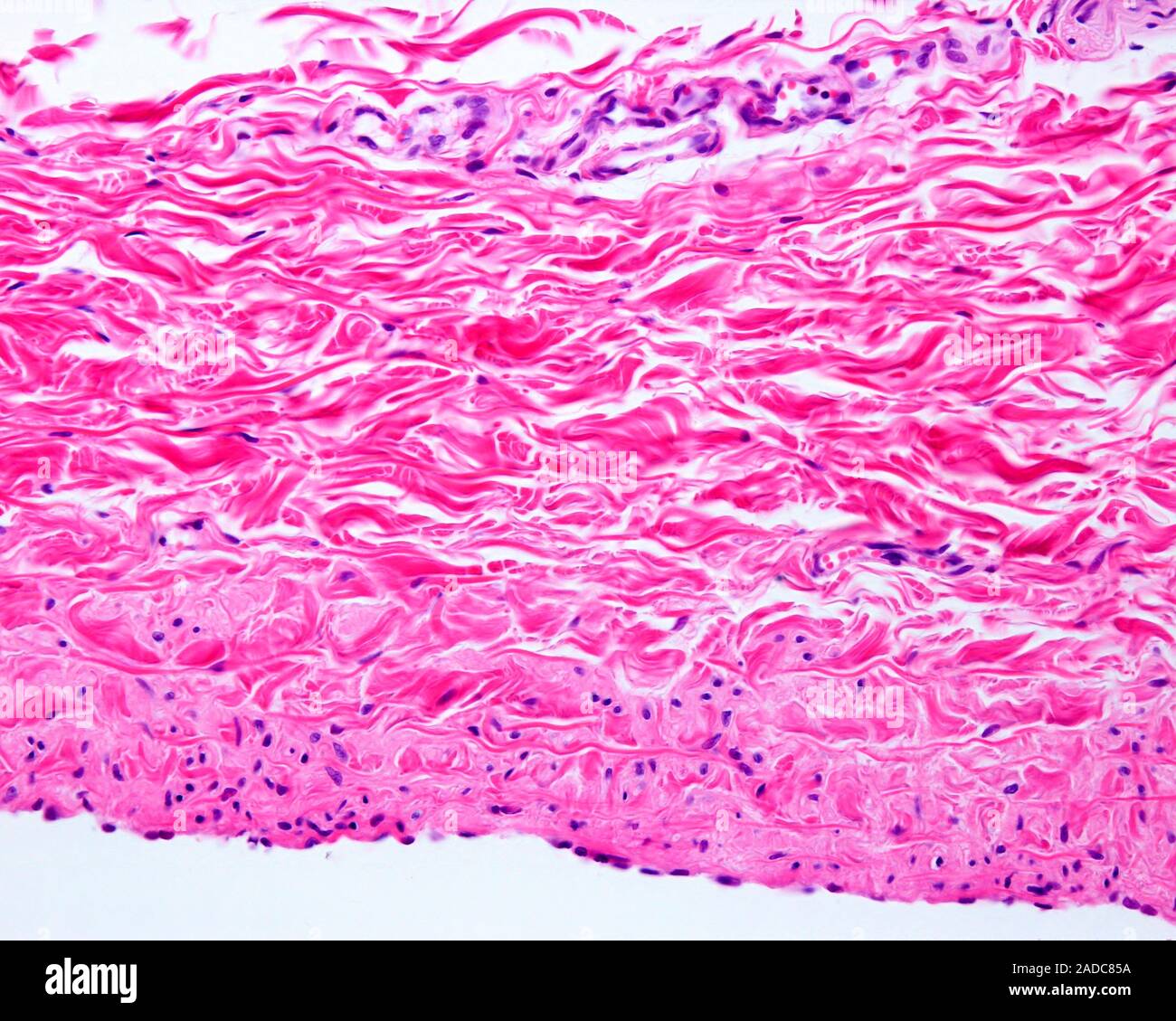 Micrografia di luce di una sezione longitudinale di una grande vena ...
